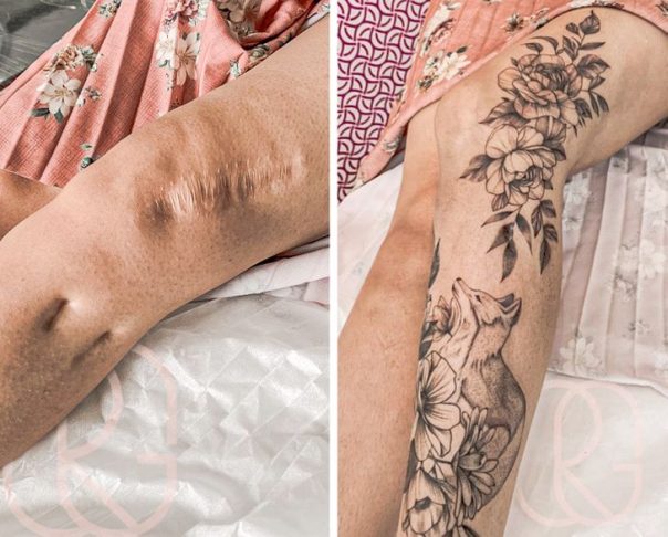 16 Iconic Transformations Of Scars Into Beautiful Tattoos