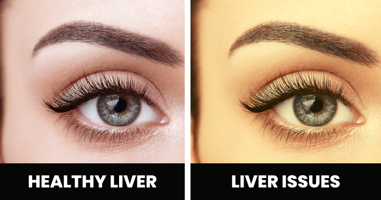 10 Symptoms That May Reveal Health Problems