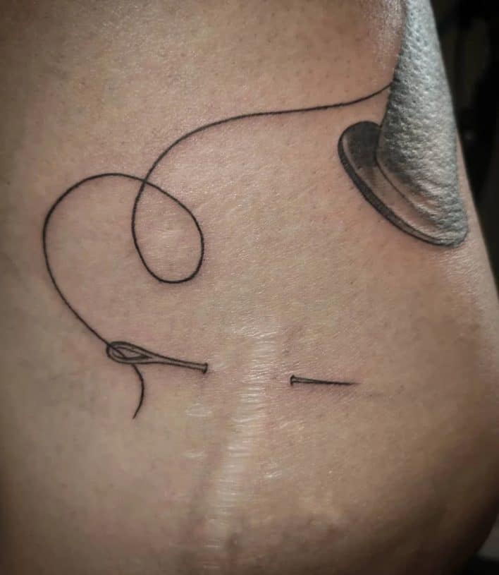 Viral Strange - 15 Amazing Birthmark And Scar Transformations