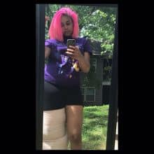 Viral Strange - Gorgeous Girl With a 100-lb Leg Inspires People To ...