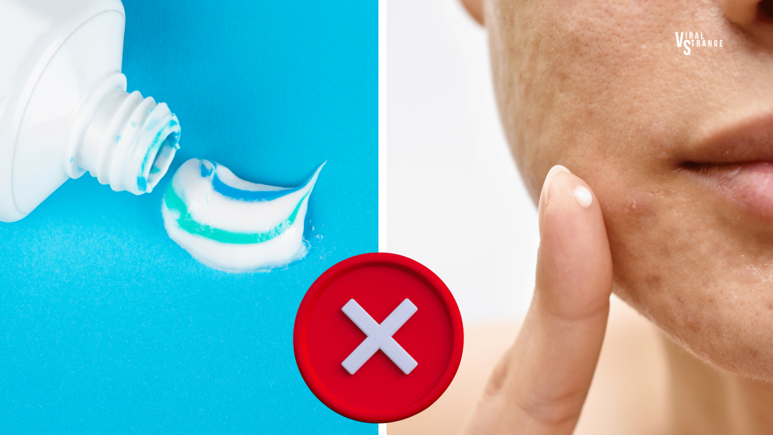 Viral Strange - 7 Things That Clog Your Pores And Cause Acne