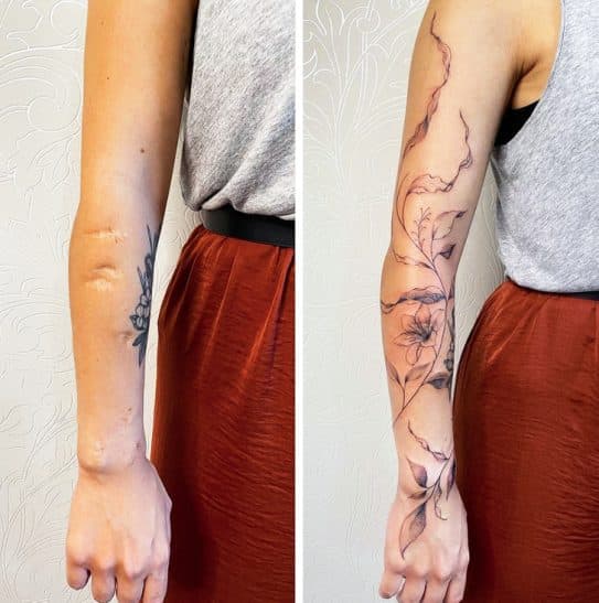 Viral Strange - Ugly Scars Transformed By This Talented Tattoo Artist