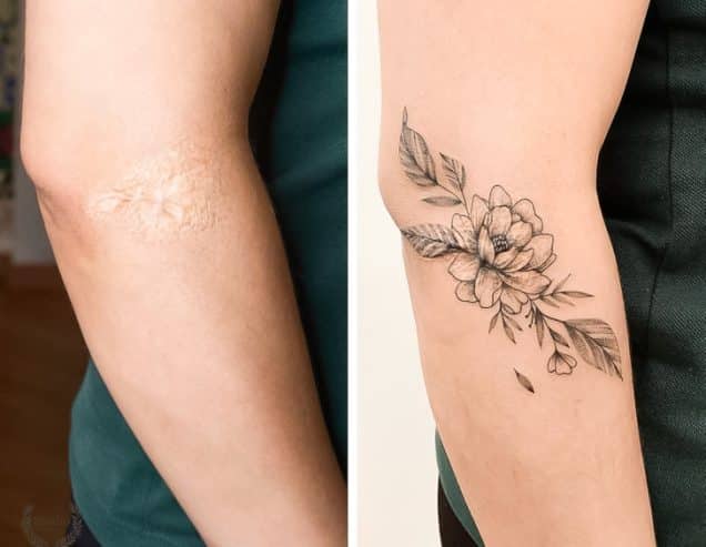 Viral Strange - Ugly Scars Transformed By This Talented Tattoo Artist
