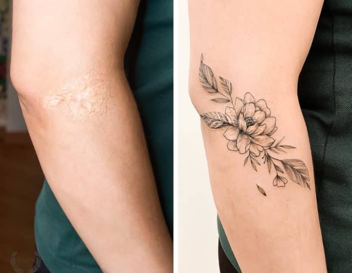 Ugly Scars Transformed By This Talented Tattoo Artist