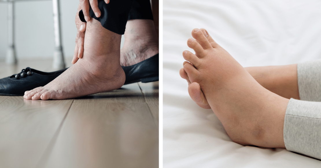 Body Alerts For Possible Health Issues