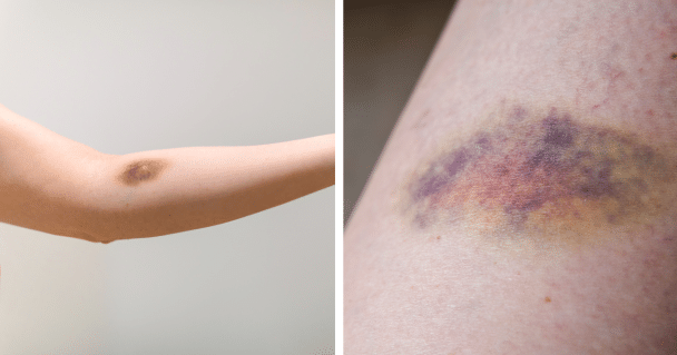 Body Alerts For Possible Health Issues