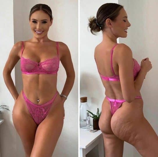Viral Strange - Normalizing Normal Bodies: Influencer Shares 'Unedited' Photos