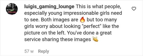 Normalizing Normal Bodies: Influencer Shares 'Unedited' Photos