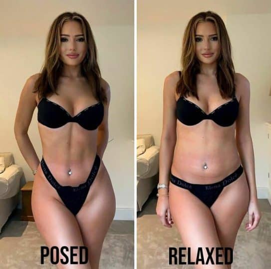Viral Strange - Normalizing Normal Bodies: Influencer Shares 'Unedited' Photos
