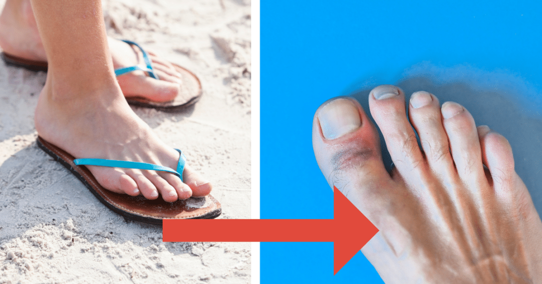 Viral Strange - Flip-Flops: Why Ditching Them Might Be Good