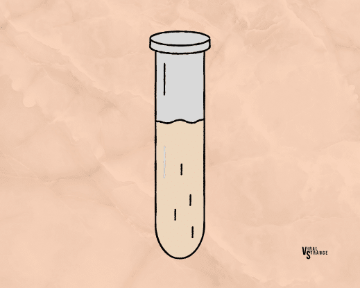 Urine Color: What Does It Say About Your Health