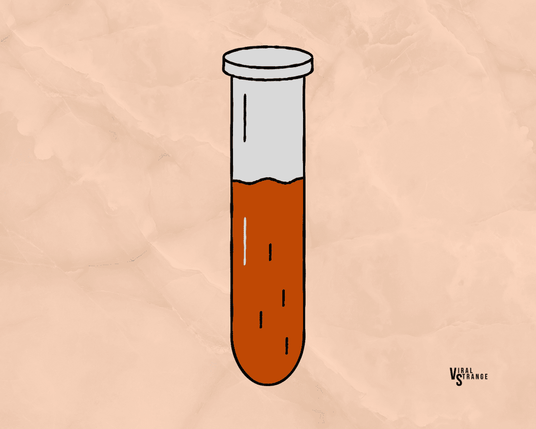 Urine Color: What Does It Say About Your Health