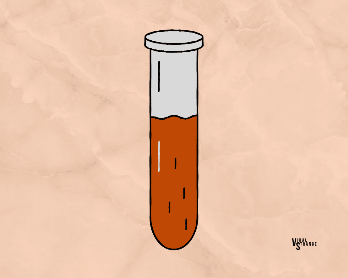Viral Strange - Urine Color: What Does It Say About Your Health