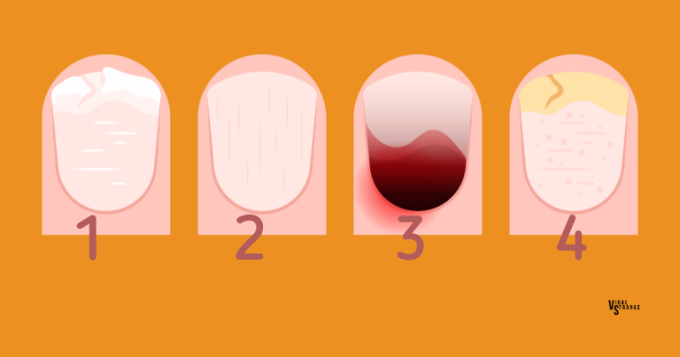 Viral Strange - Nails: What Do They Reveal About Your Health