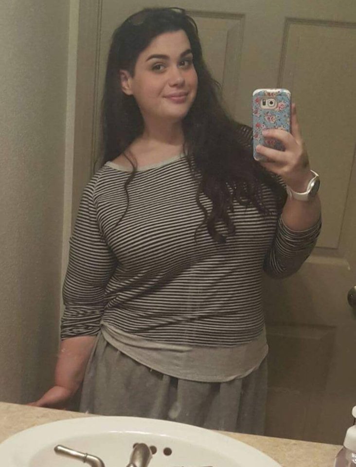 Viral Strange - Amber Rachdi: The Instagram Star Before & After