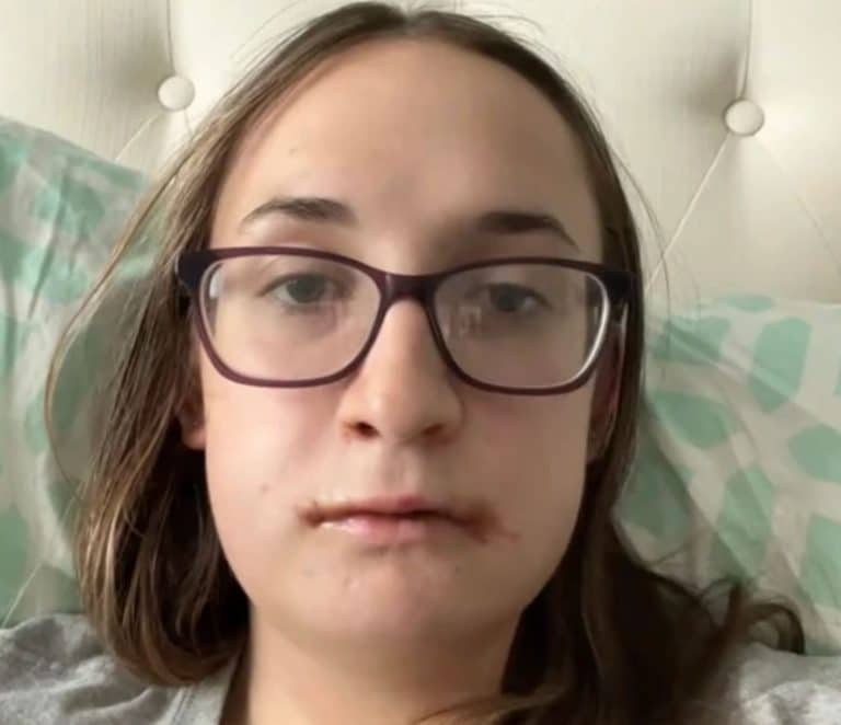 Viral Strange - Young Woman Goes Viral After Showcasing Jaw Surgery ...