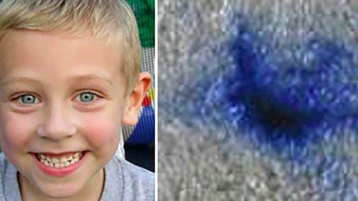 Trypophobia: 15 Pics That Will Make You Cry in Fear