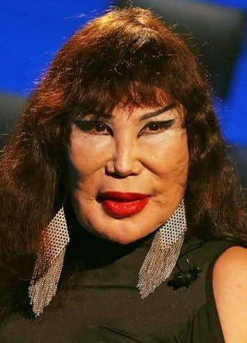 Lyn May and Her Tragic Story That Changed Her Appearance