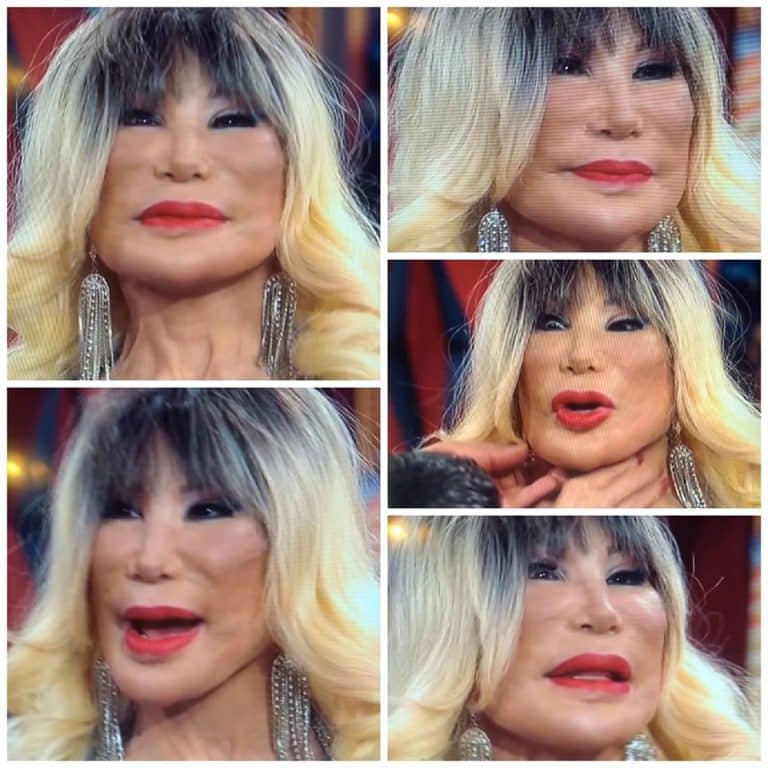 Lyn May and Her Tragic Story That Changed Her Appearance
