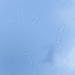 Viral Strange - Understanding Eye Floaters: Causes and When to Seek Help