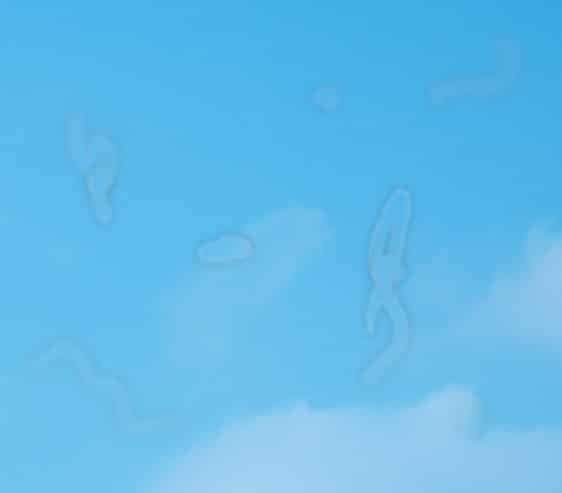 Understanding Eye Floaters: Causes and When to Seek Help