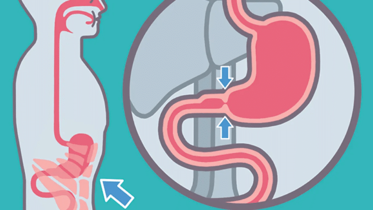 Body's Vomiting Mechanism: A Fascinating Simulation