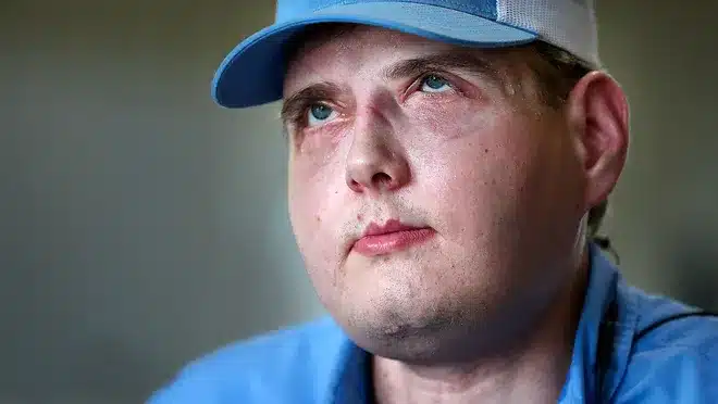 Viral Strange - Patrick Hardison, From Tragedy to Triumph with a ...