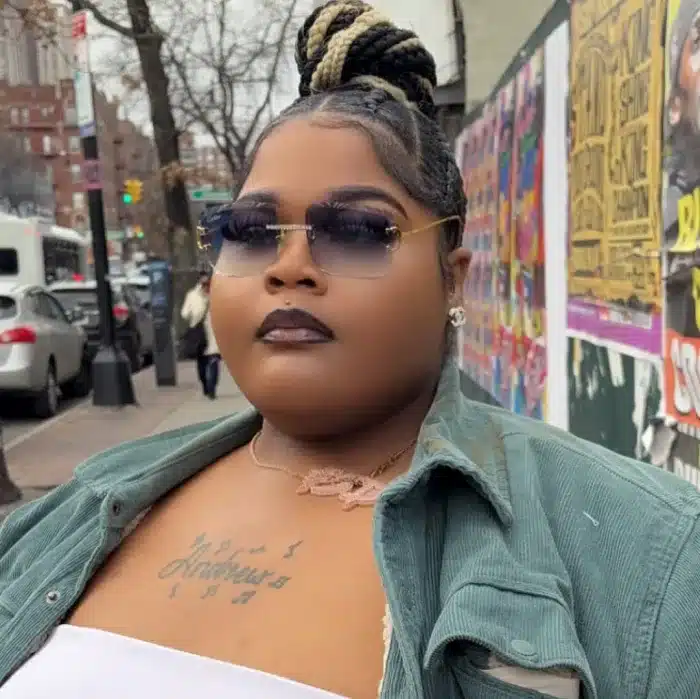 Viral Strange - Benjamin Button Syndrome: Meet the Rare Twins Who Have It