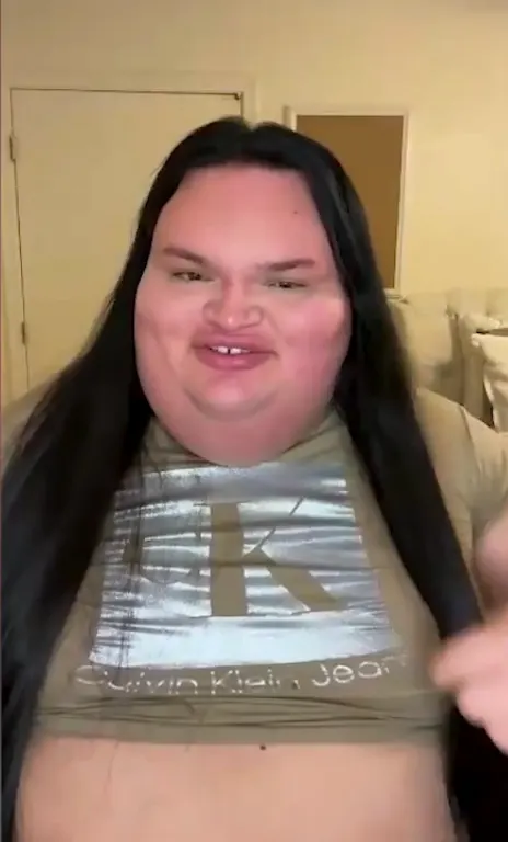 Viral Strange - Influencer Unveils Remarkable Transformation After 5 ...