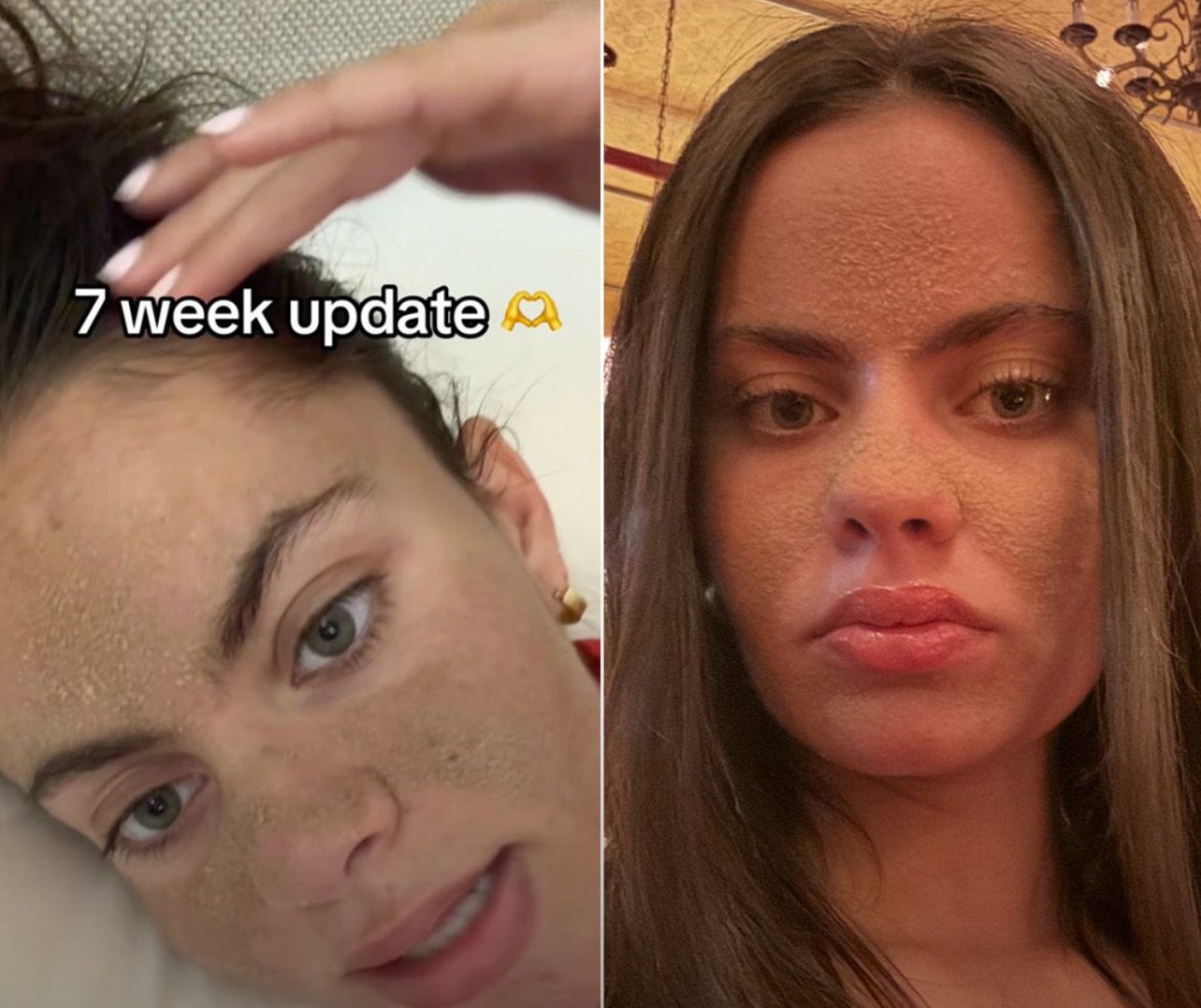 22-year-old tiktoker goes viral for not washing her face for 7 weeks in a new ‘skincare routine’
