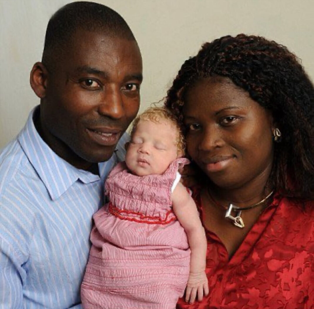 A Nigerian couple gave birth to a blonde haired blue eyes white baby ...